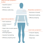 ALS Facts and Symptoms Overview | ALS Pathways